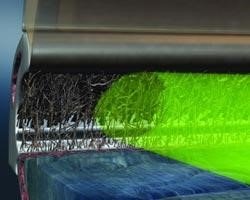 Selective Laser Trabeculoplasty - Boulder Eye Surgeons